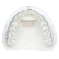 Splints | Five Star Orthodontic