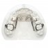 Distalizers - Five Star Orthodontic