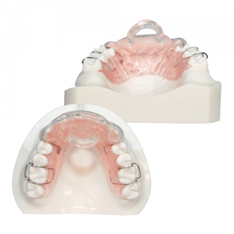 Splints | Five Star Orthodontic