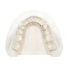 Splints | Five Star Orthodontic