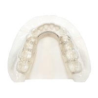 Splints | Five Star Orthodontic