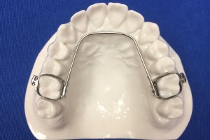 Expanders - Five Star Orthodontic