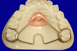 Retainers - Five Star Orthodontic