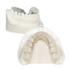 Splints | Five Star Orthodontic
