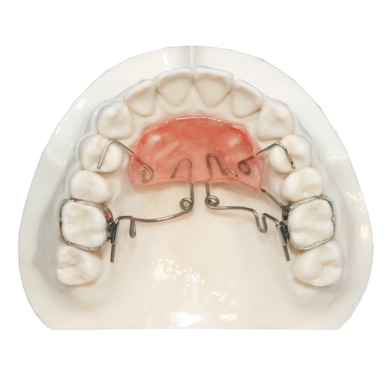 Distalizers | Five Star Orthodontic
