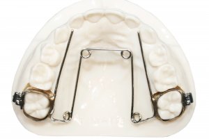 Expanders - Five Star Orthodontic