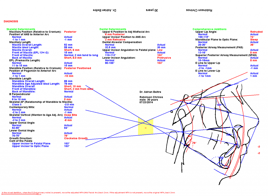 Cephalometrics | Five Star Orthodontic