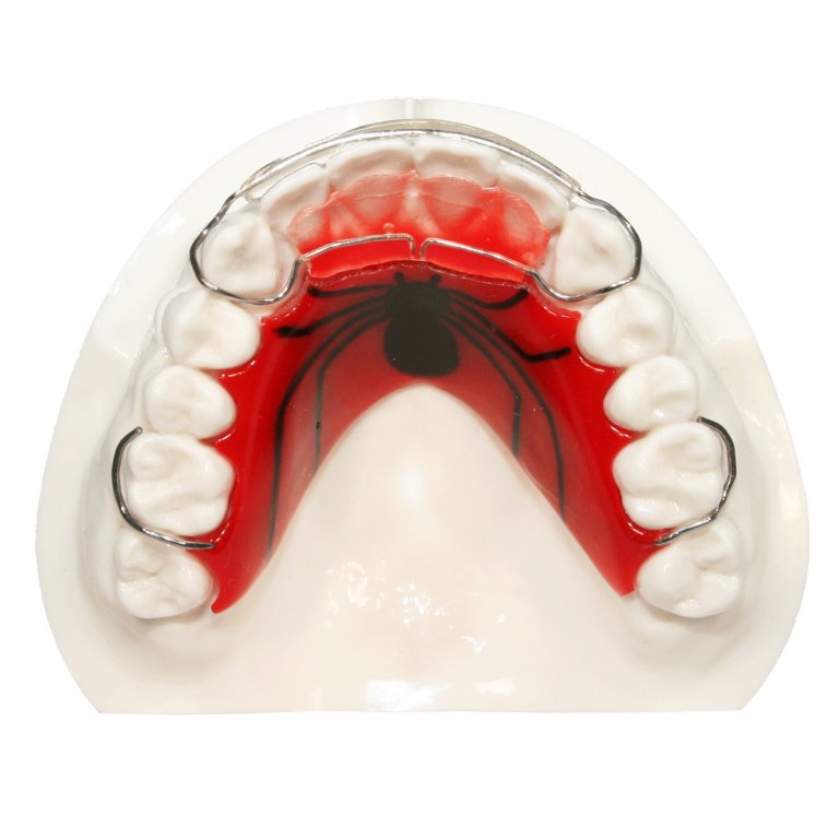 Retainers | Five Star Orthodontic