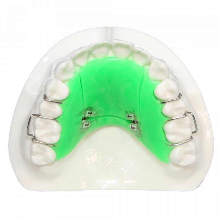 Appliances | Five Star Orthodontic