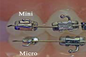 Five Star Orthodontic - Orthodontic Laboratory & Supply