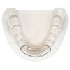 Retainers | Five Star Orthodontic