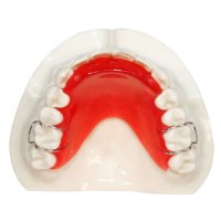 Class II Appliances | Five Star Orthodontic