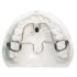 Habit Appliances | Five Star Orthodontic
