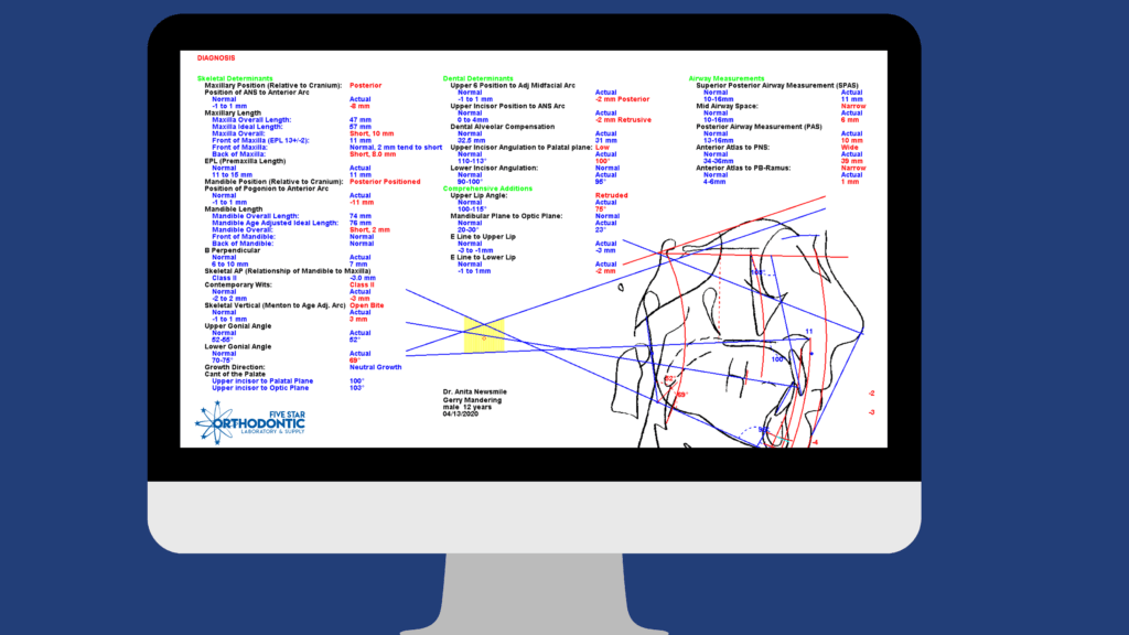 Sassouni Plus Tracing System | Five Star Orthodontic