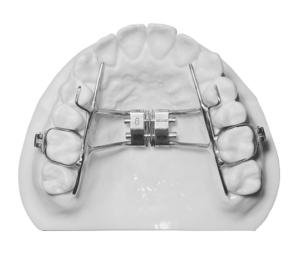Expanders - Fivestar Ortho