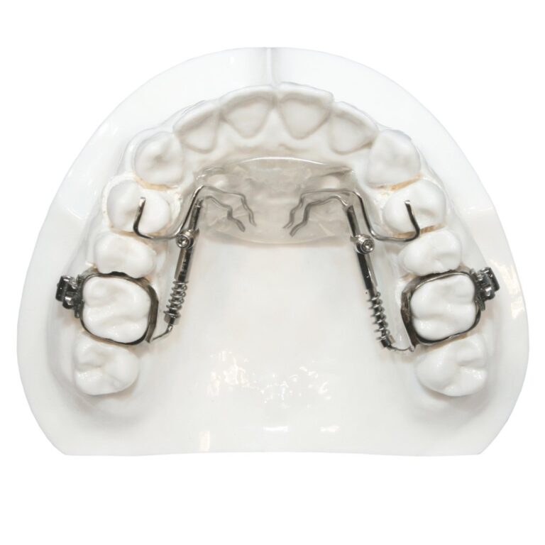 Distalizers - Fivestar Ortho