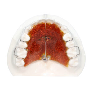 Expanders - Fivestar Ortho