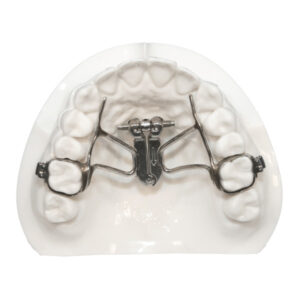 Expanders - Fivestar Ortho