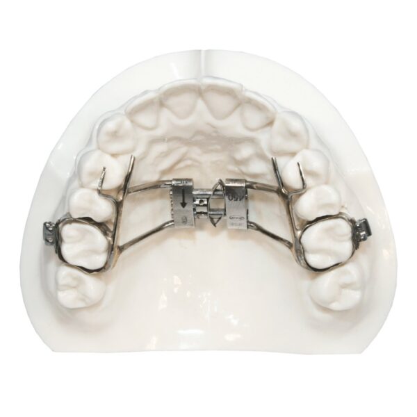 Expanders - Fivestar Ortho