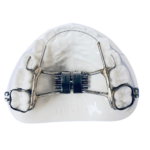 Expanders - Fivestar Ortho