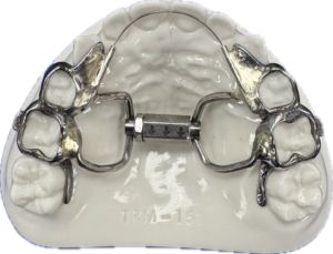 Expanders - Fivestar Ortho